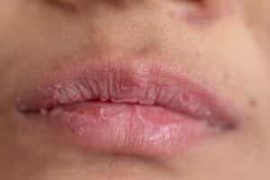 O que fazer quando os lábios ficam ressecados? - Fernanda Freitas Makeup